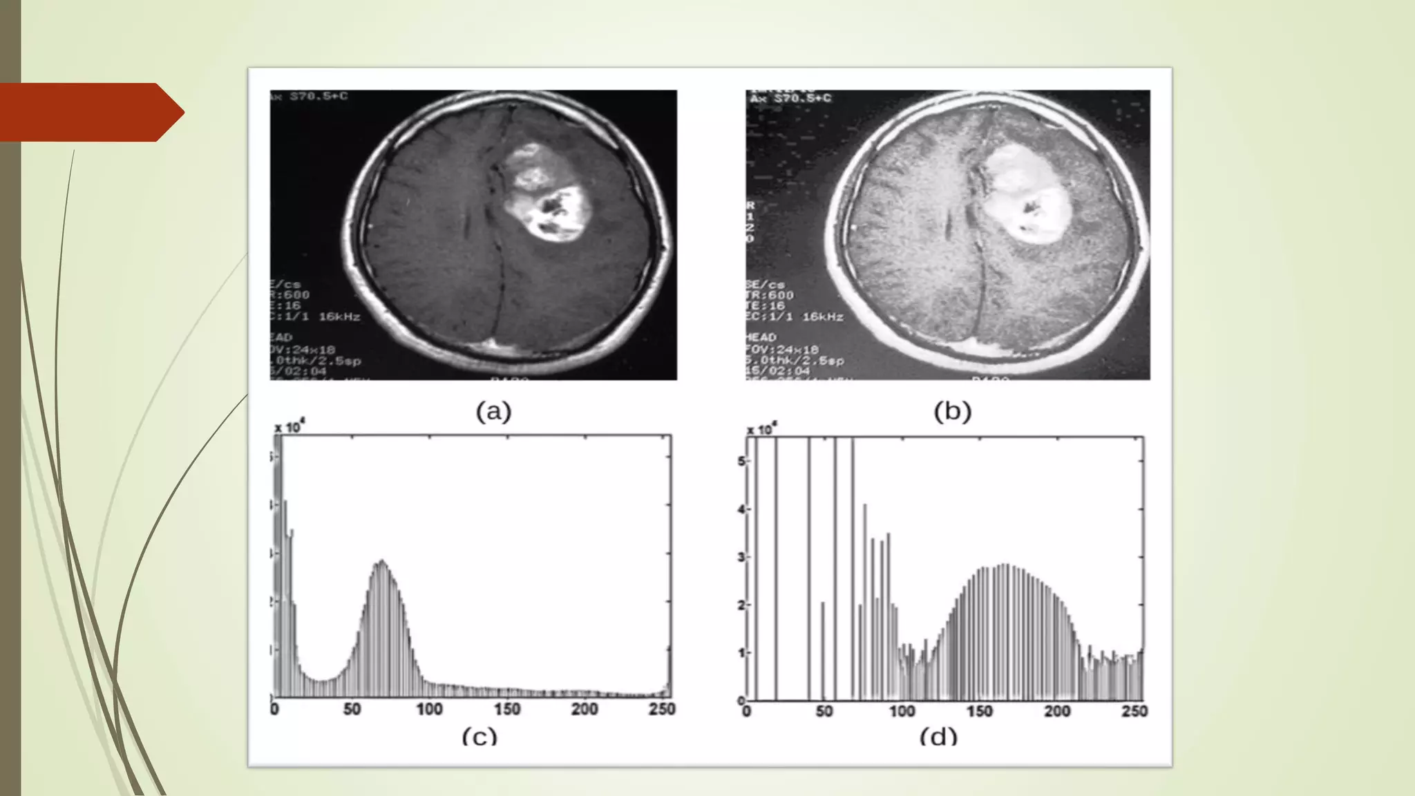 Medical image enhancement using histogram processing part1 | PPT