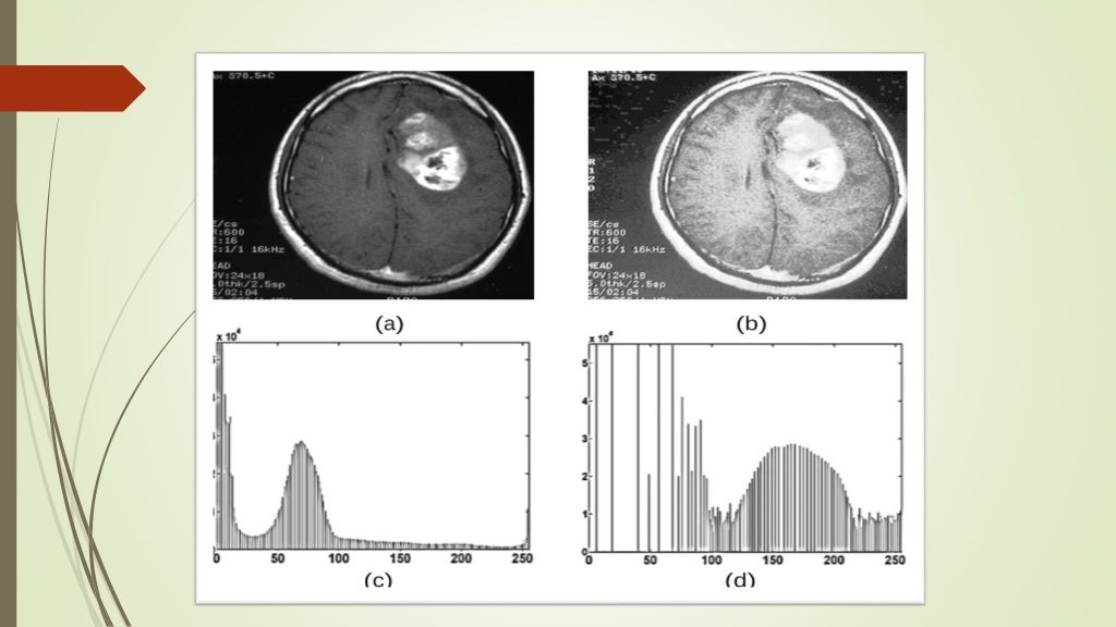 Medical Image Enhancement Using Histogram Processing Part1
