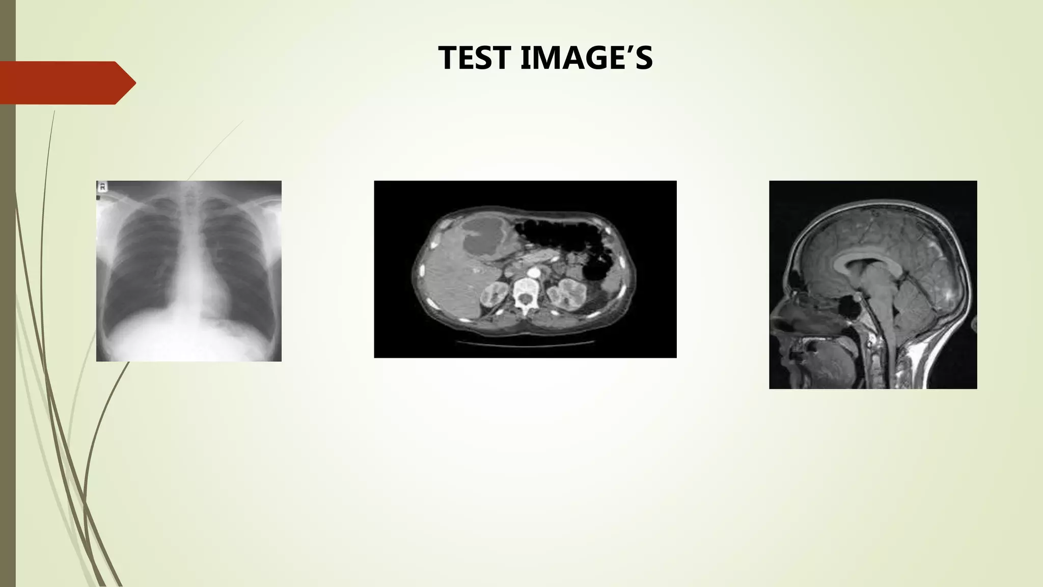 Medical image enhancement using histogram processing part2 | PPT