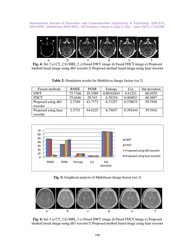Medical image fusion using curvelet transform 2-3-4-5 | PDF