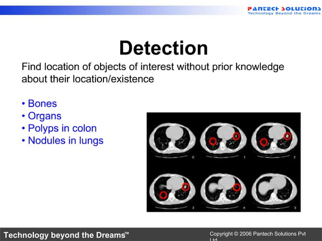 Medical Image Processing | PPT