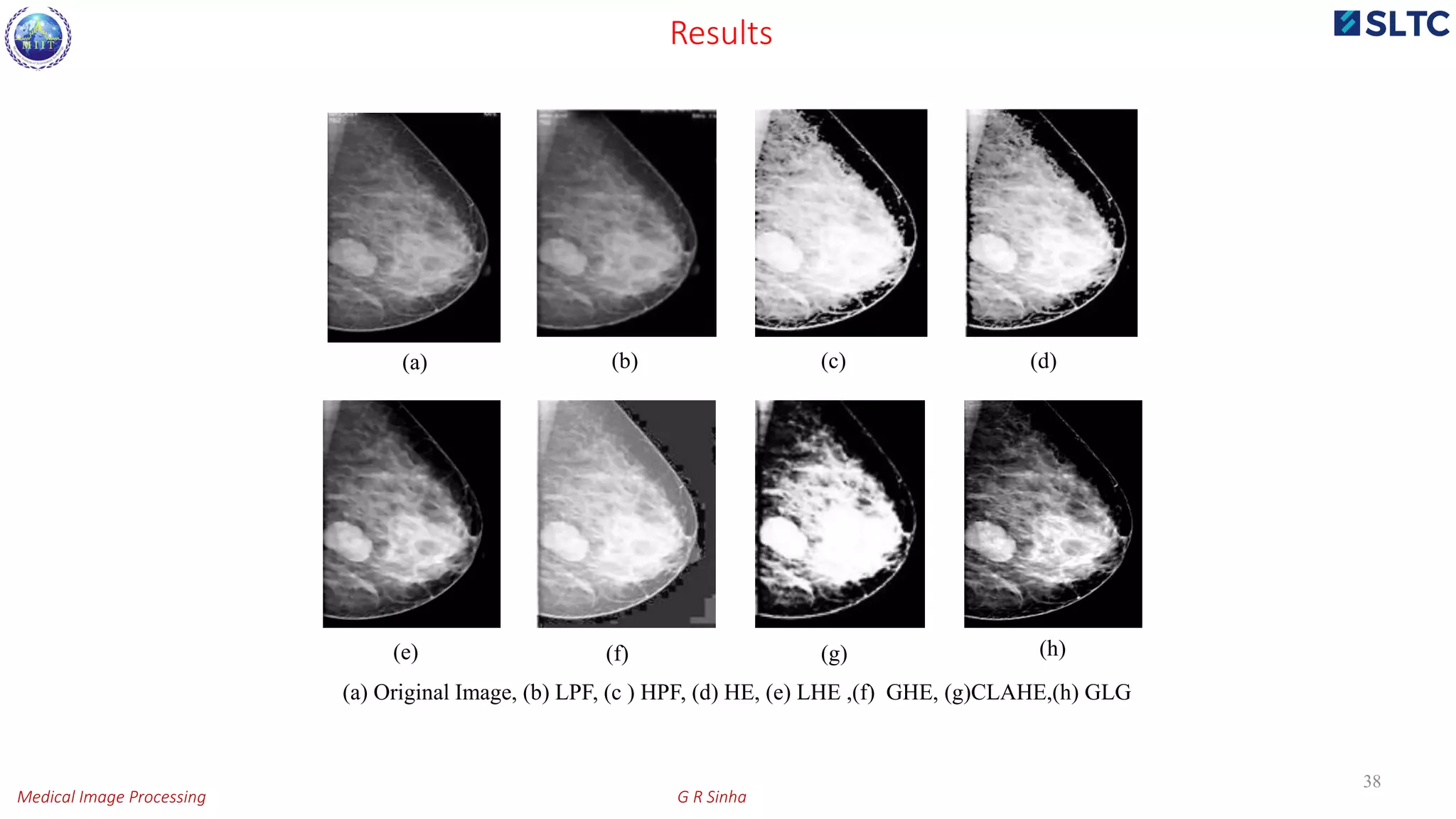 Medical image processing | PDF