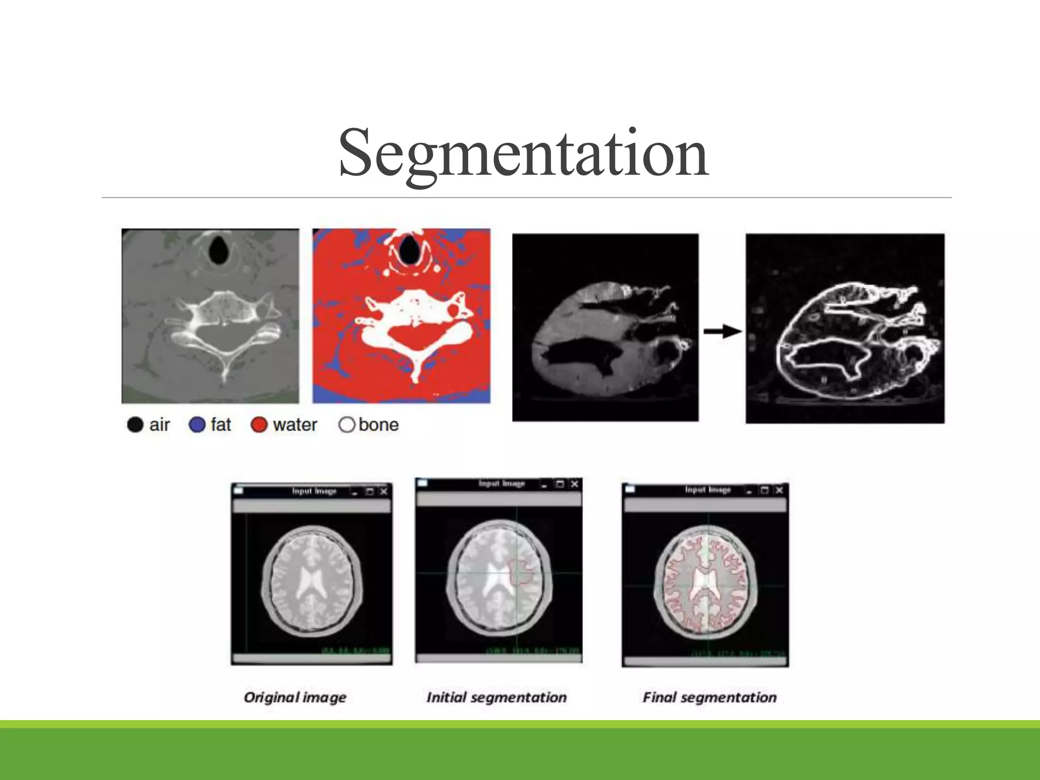 Medical_Image_Processing-首节课.pptx
