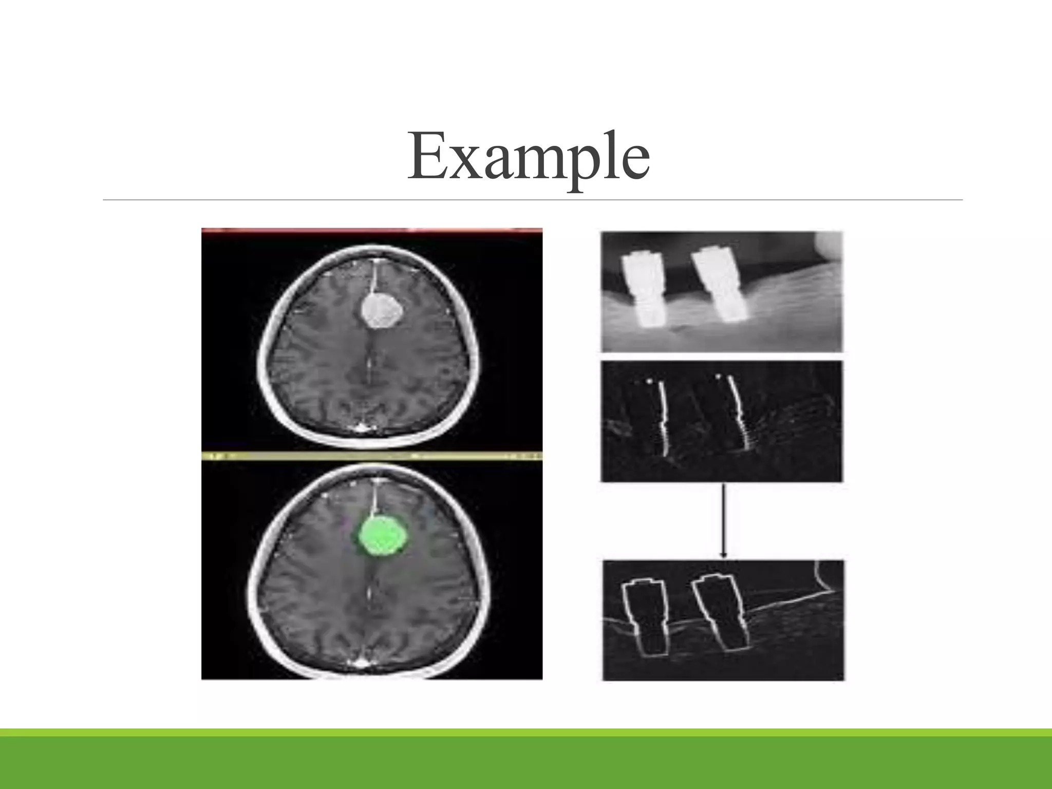 Medical_Image_Processing-首节课.pptx