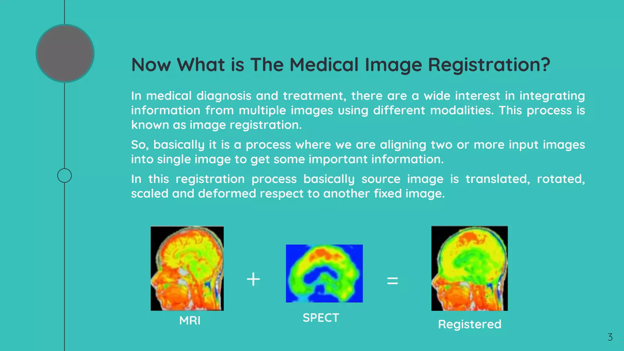 Medical image registration ppt.potx