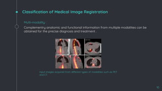 Medical image registration ppt.potx