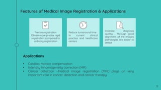 Medical image registration ppt.potx
