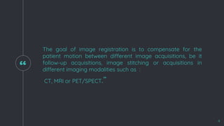 Medical image registration ppt.potx