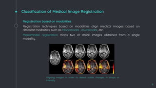 Medical image registration ppt.potx