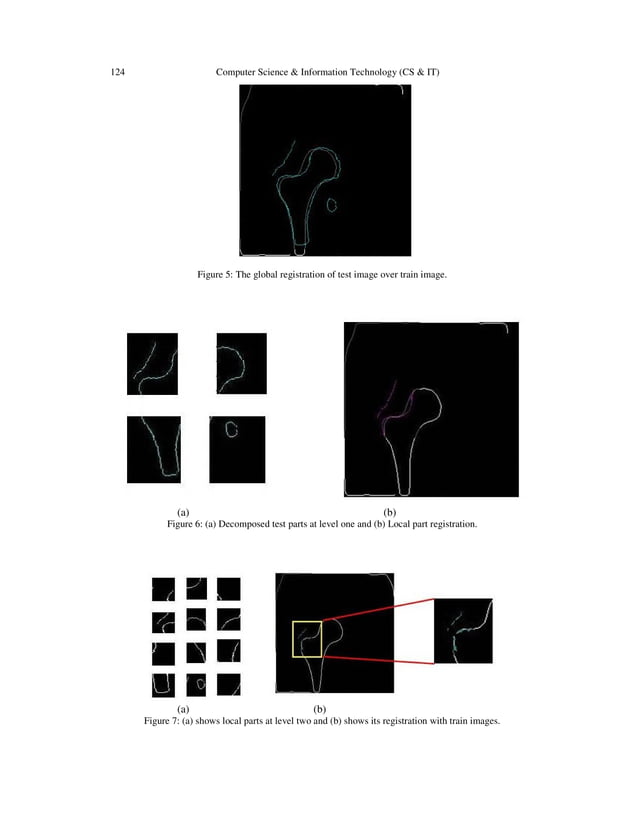 Medical Image Segmentation by Transferring Ground Truth Segmentation Based upon Top Down and ...