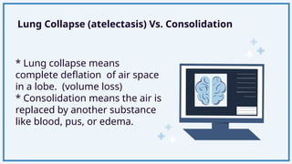 presentation about imaging of lung collapse | PPTX