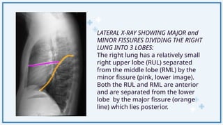 presentation about imaging of lung collapse | PPTX