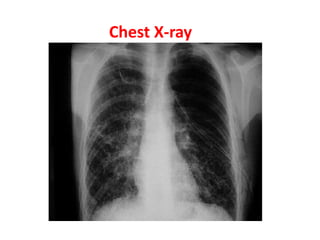 Medical imaging modalities(2) | PPTX