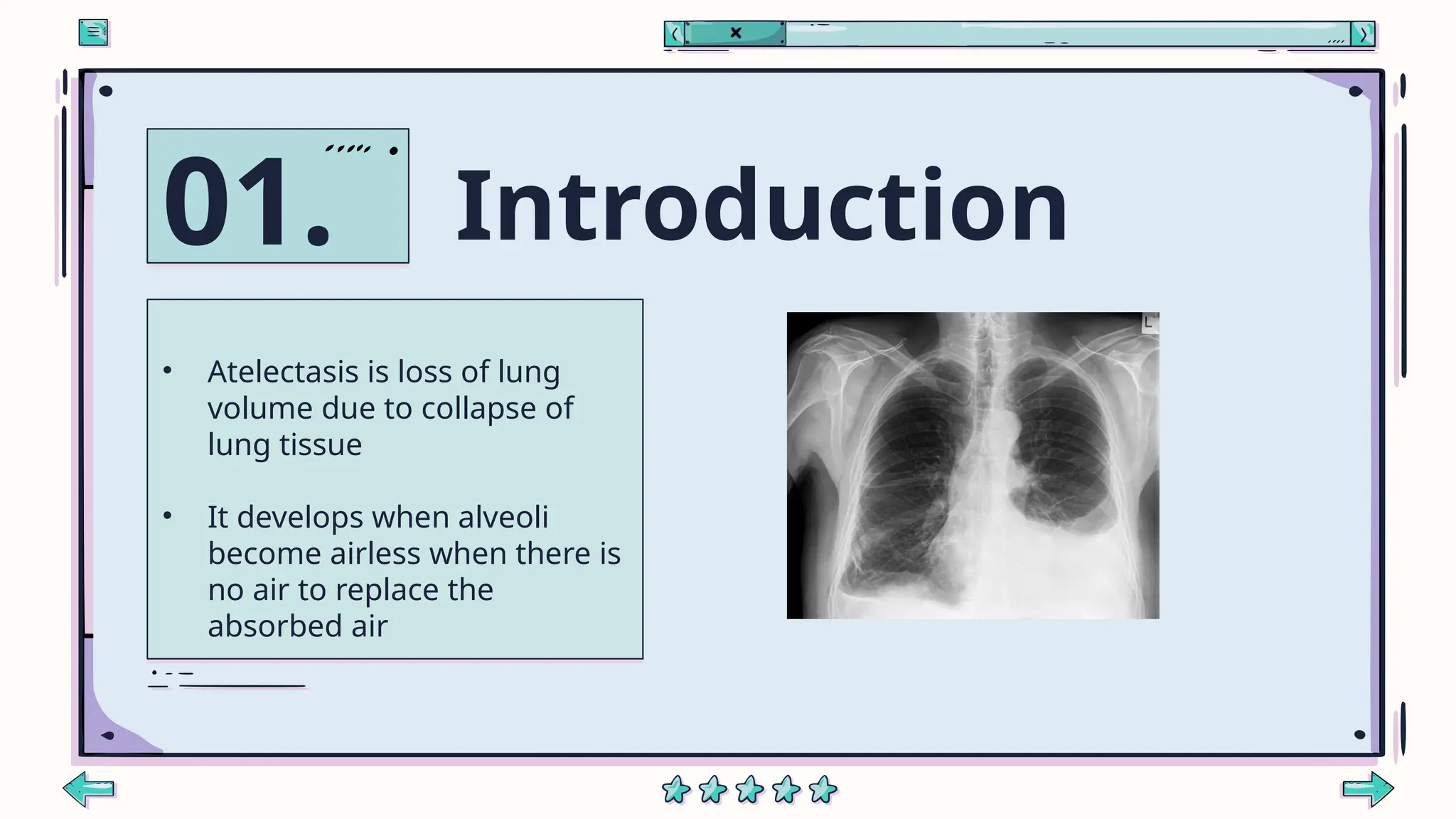 Medical Imaging Presentation - ATELECTASIS.pptx