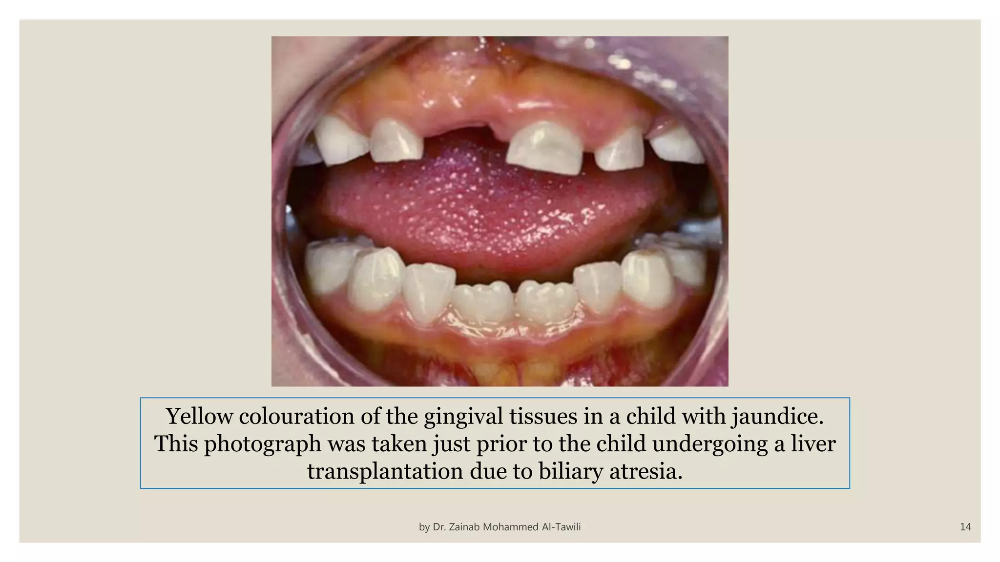 Medically compromised children 2 | PPTX