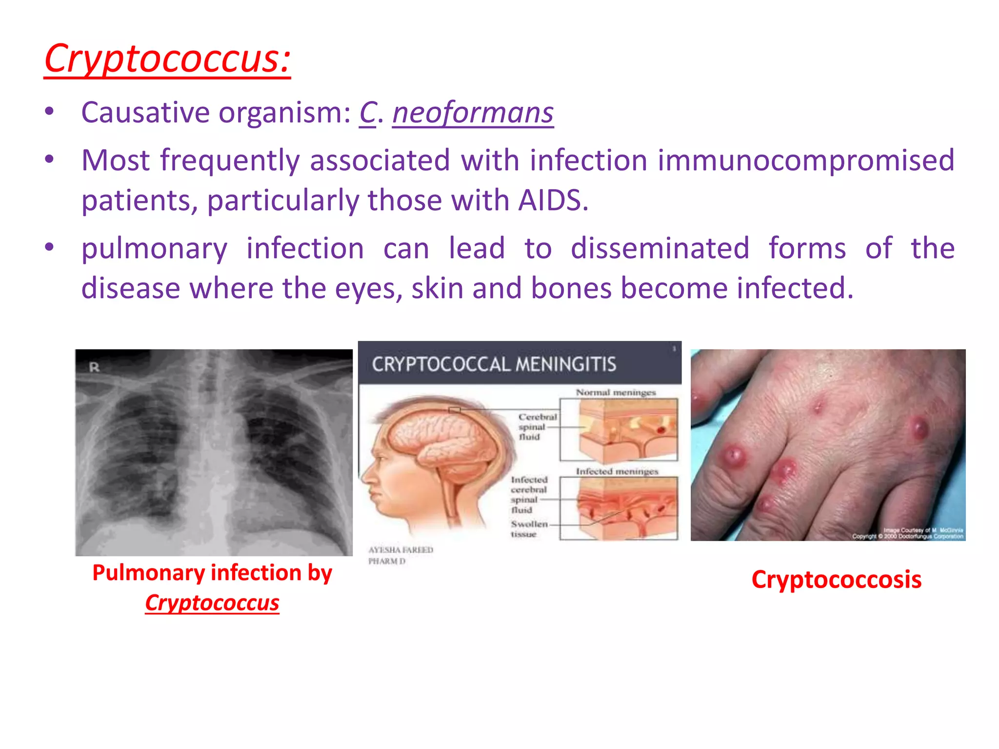 Medically Significant Yeasts | PPTX