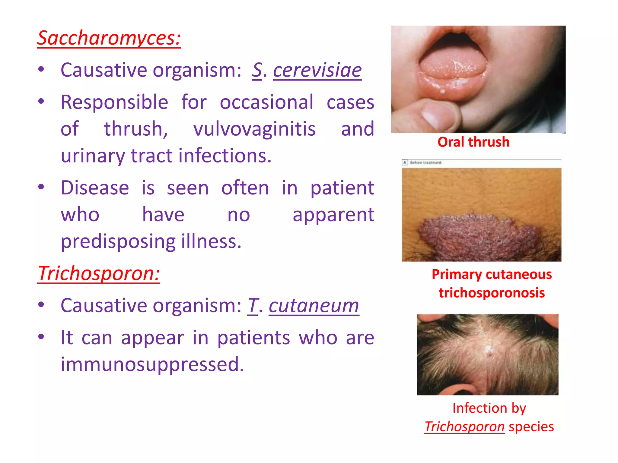 Medically Significant Yeasts | PPTX