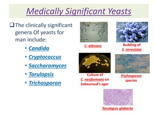 Medically Significant Yeasts | PPTX