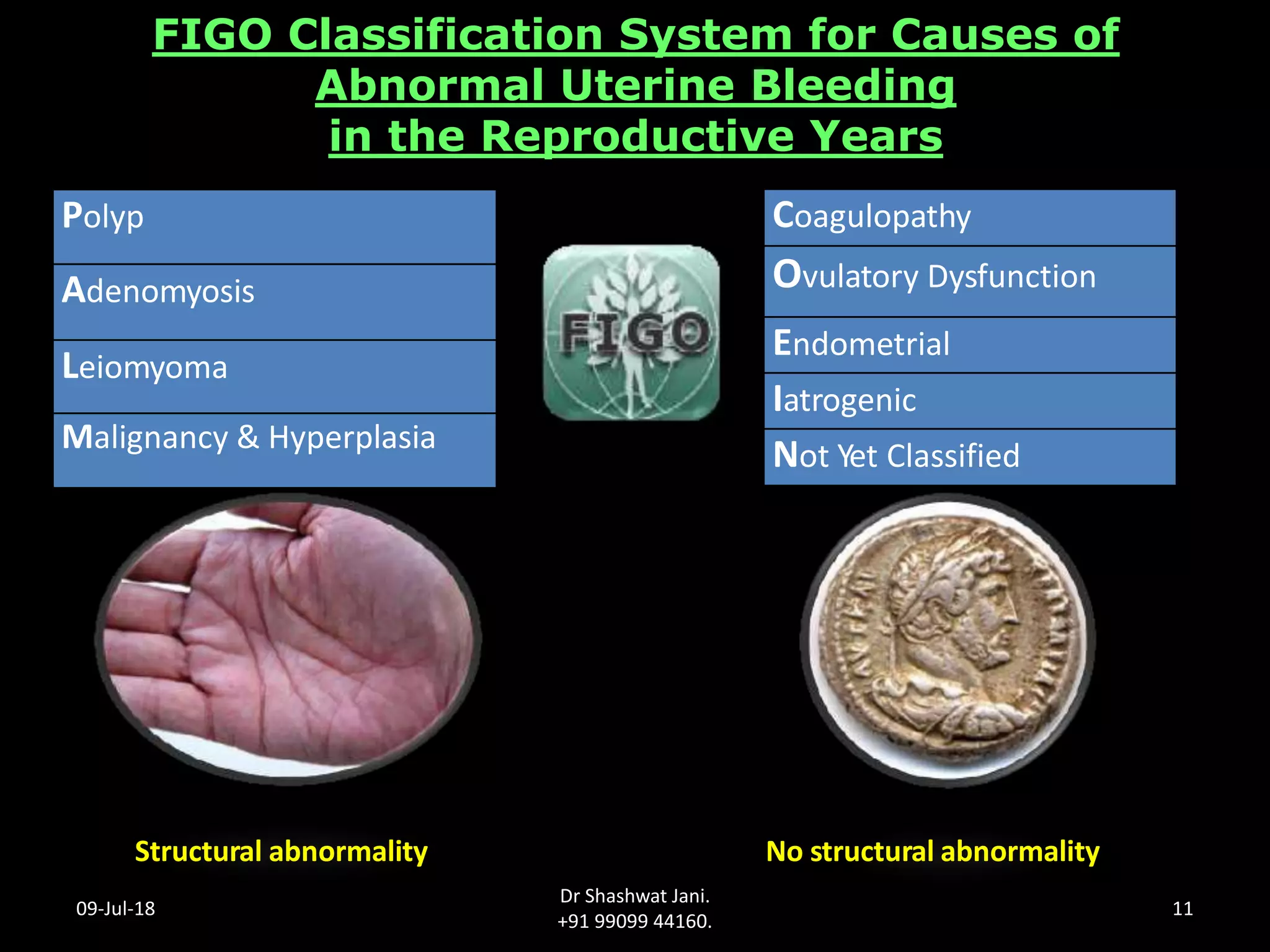 MEDICAL MANAGEMENT OF ABNORMAL UTERINE BLEEDING BY DR SHASHWAT JANI | PDF