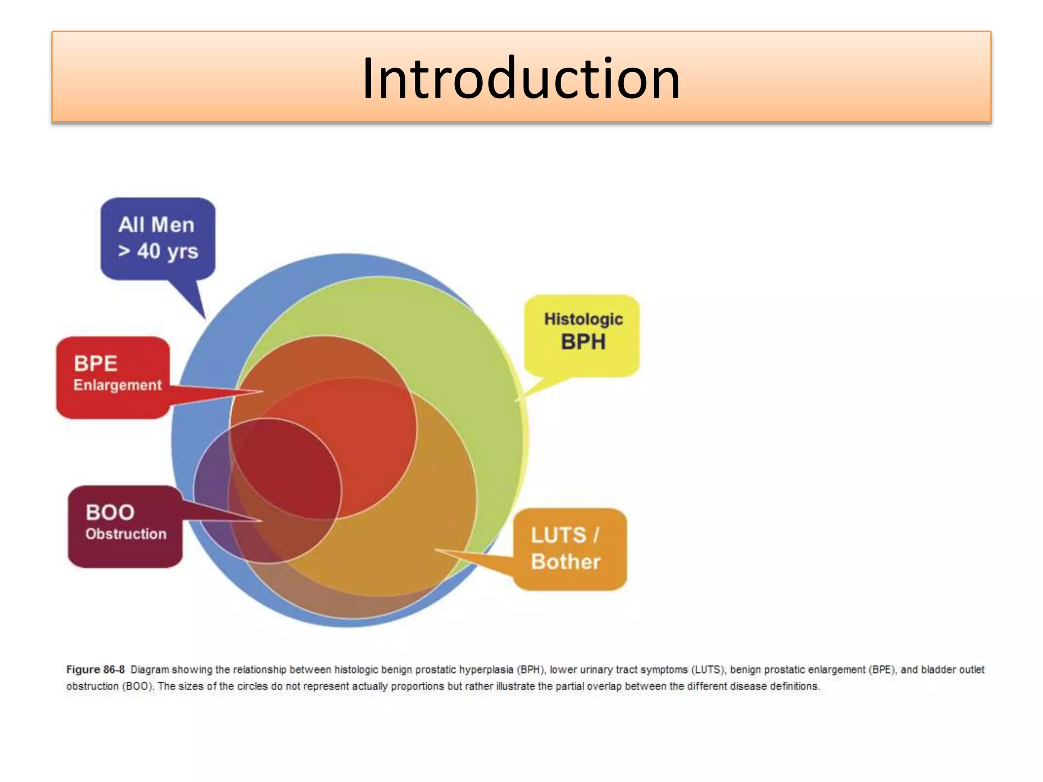 Medical management of bph | PPTX