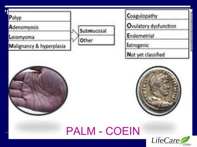 Medical management of dub – new modalities | PPT