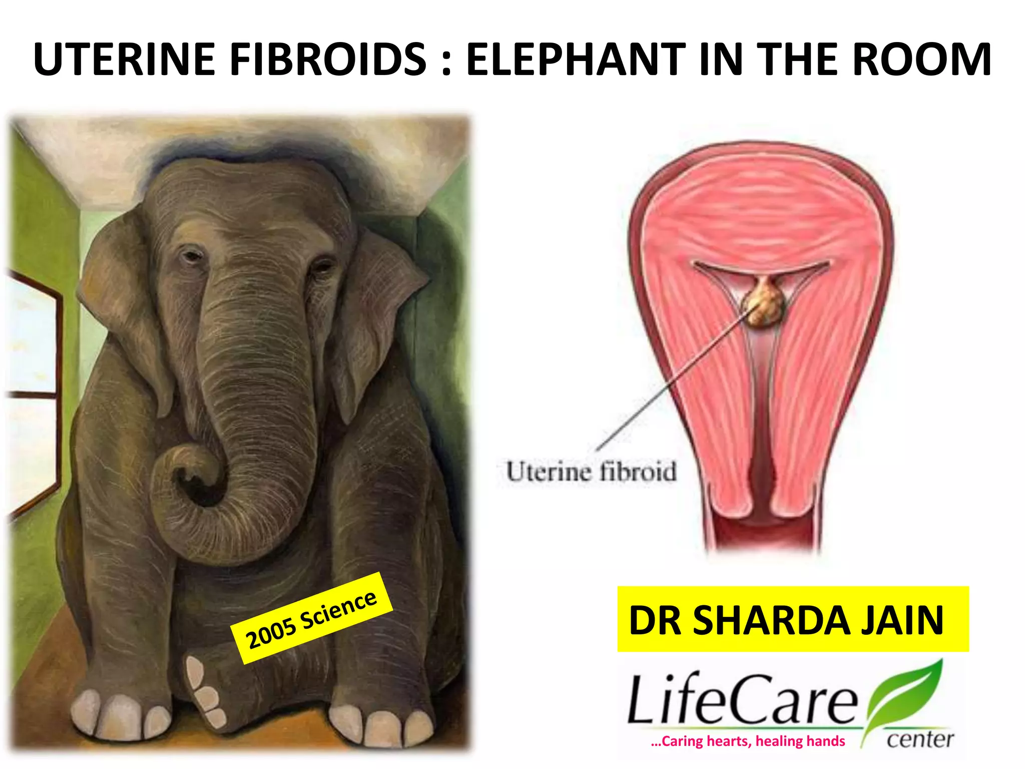 Medical Management of fibroid focus on Low Does Mifepristone Dr Sharda Jain Dr Jyoti Agarwal | PPTX