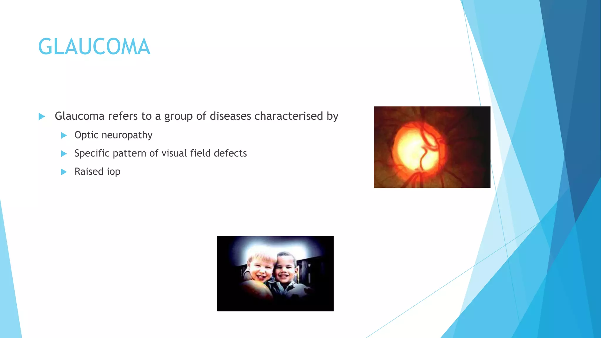Medical management of glaucoma | PPTX