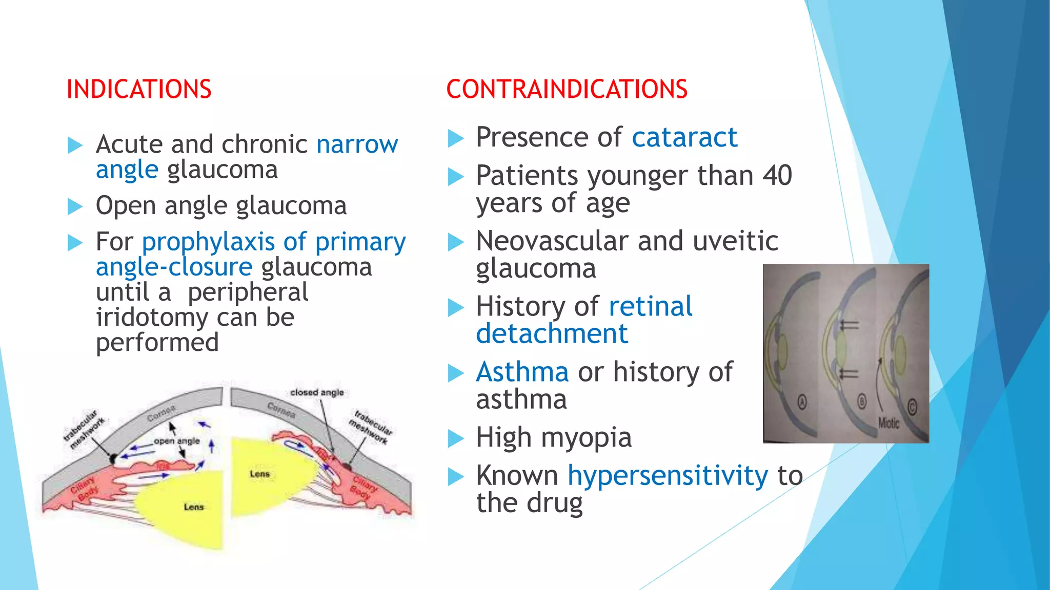 Medical management of glaucoma | PPTX