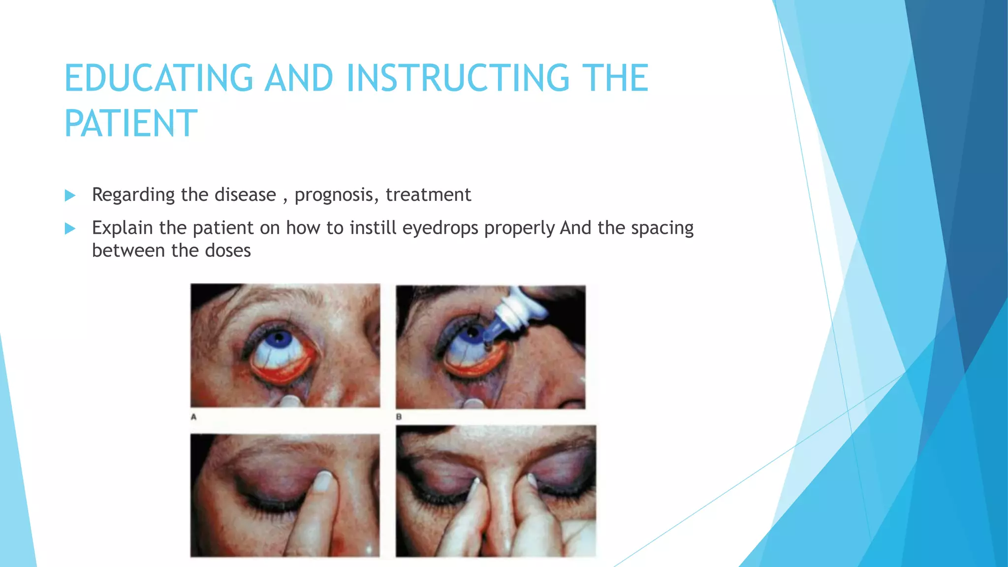 Medical management of glaucoma | PPTX