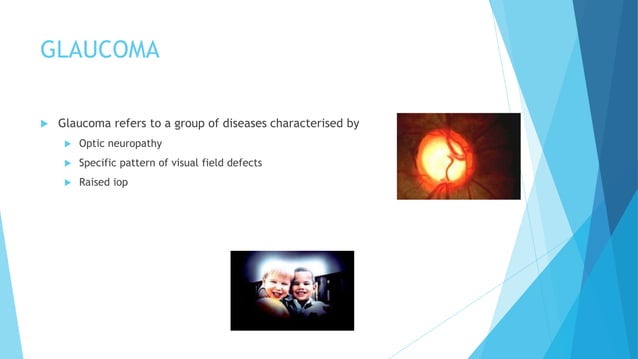 Medical management of glaucoma | PPTX | Eye and Vision Conditions ...