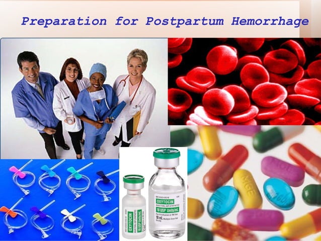 Medical management of postpartum hemorrhage pph lecture | PPT ...
