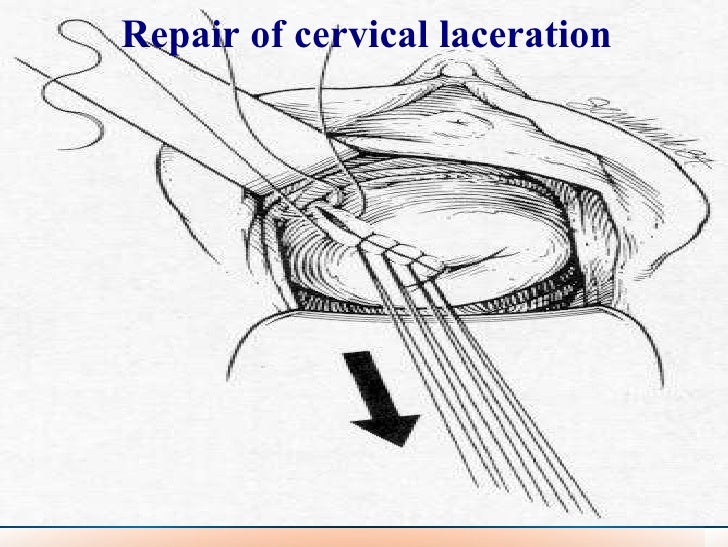 Medical management of postpartum hemorrhage pph lecture