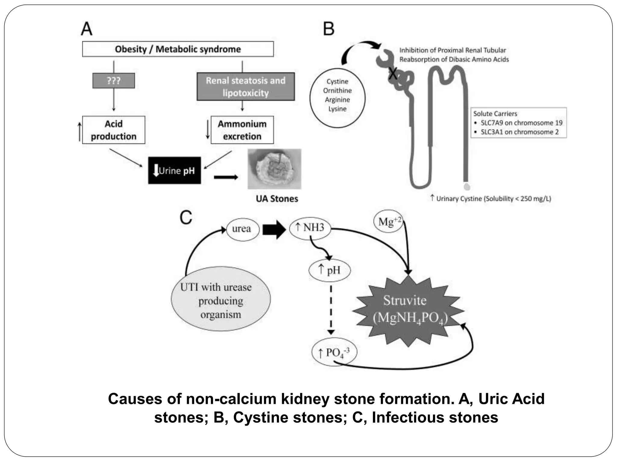 Medical management of renal stones | PPTX
