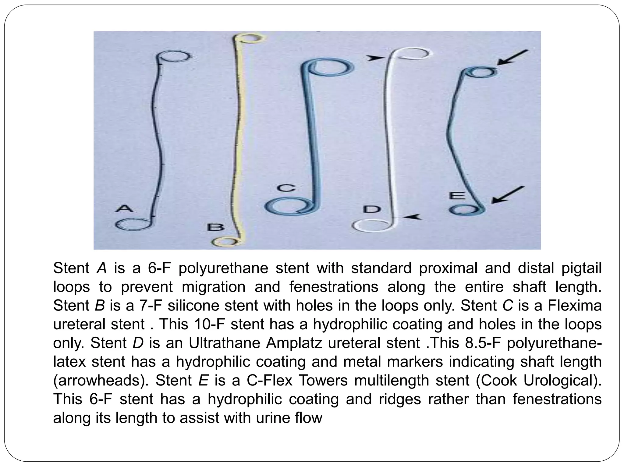 Medical management of renal stones | PPTX