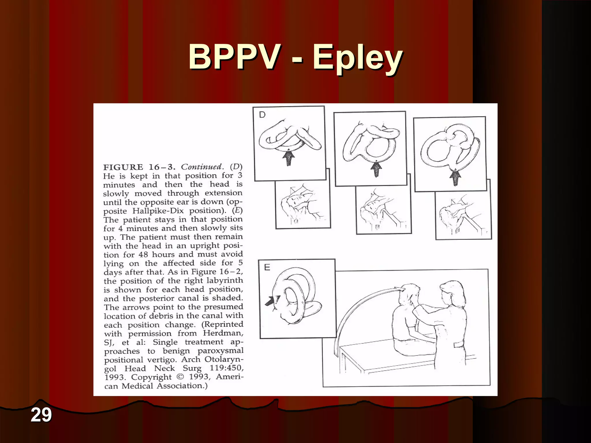 Medical management of vestibular disorders and vestibular ...