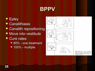 Medical management of vestibular disorders and vestibular ...