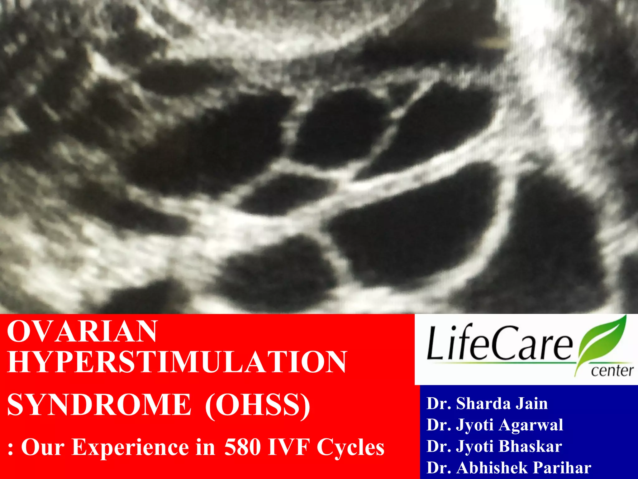 OVARIAN HYPERSTIMULATION SYNDROME (OHSS) : Our Experience in 580 IVF ...
