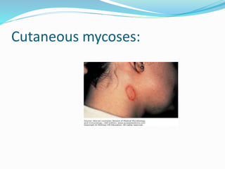 Medical microbiology | PPT