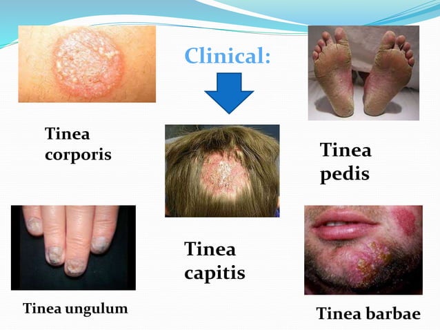 Medical microbiology | PPT
