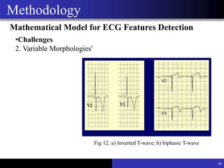 Medical multi signal signature recognition applied Cardiac Diagnosis | PPTX