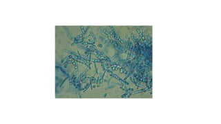 Medical Mycology Black Piedra and White Piedra.pptx