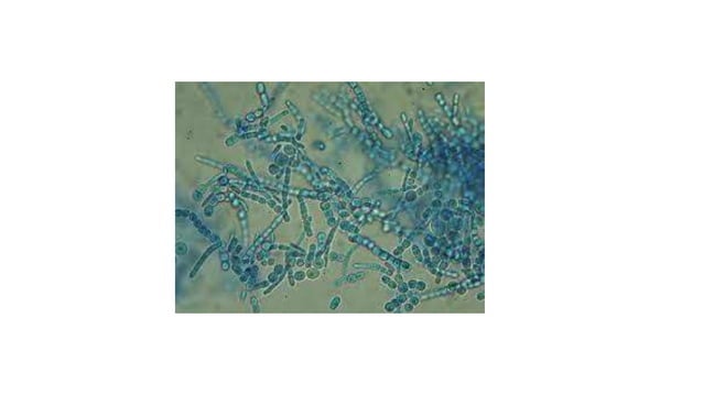 Medical Mycology Black Piedra and White Piedra.pptx | Skin and ...