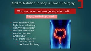 Medical nutrition therapy in ‘lower gi surgery | PPTX