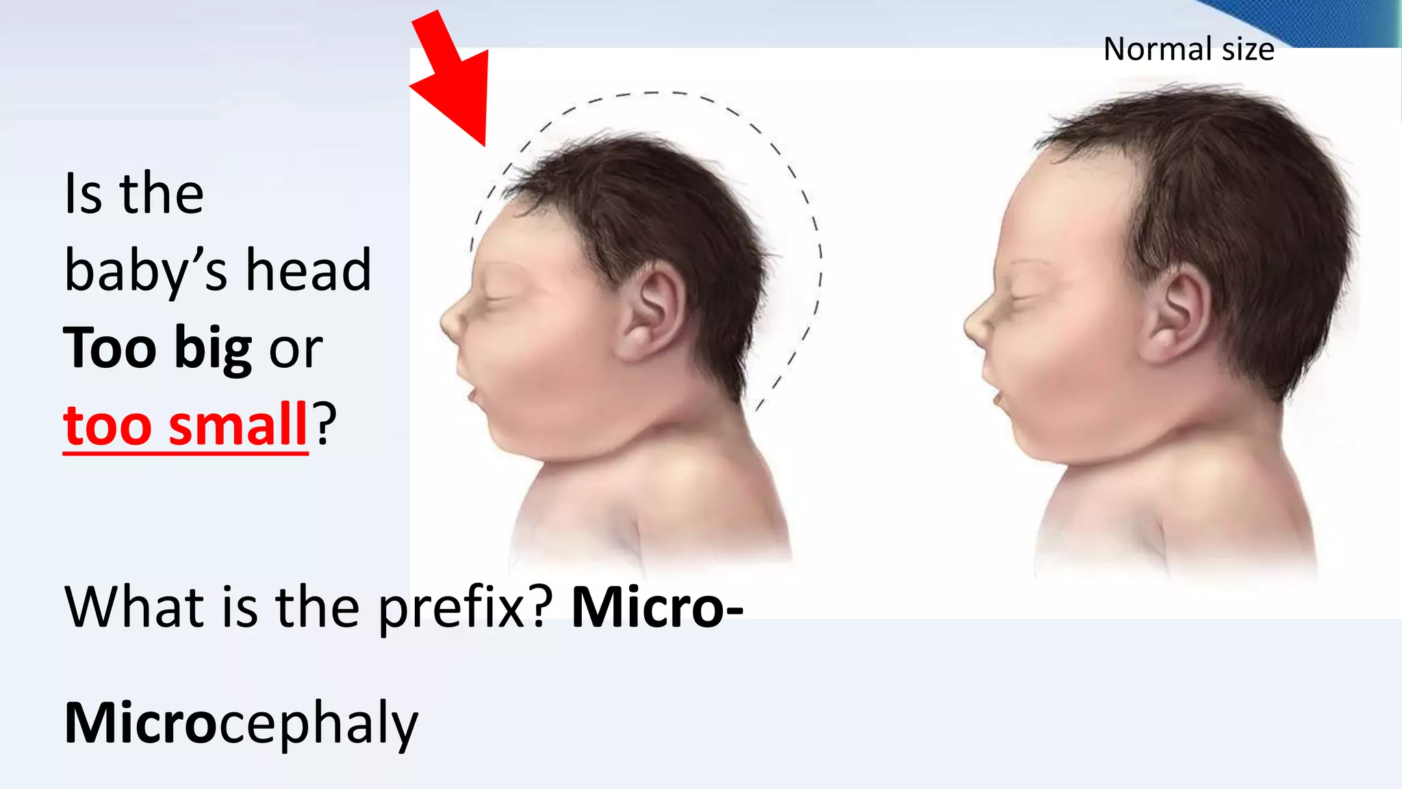 Medical Prefixes Day 2 | PPTX