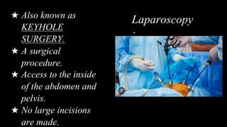 Laproscopic Cholecystectomy General Surgery PowerPoint Presentation | PPT