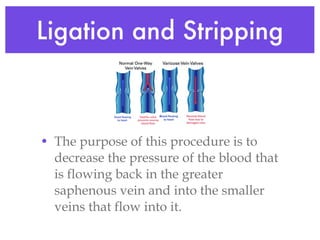 Procedure Powerpoint | PPT
