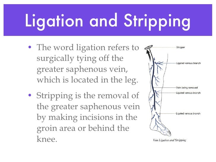 Procedure Powerpoint