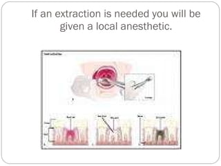 Medical Procedures | PPT