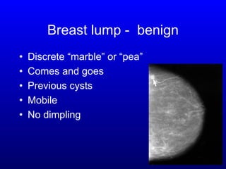 Breast Disease and Management Miss Dunn RD&E | PPT