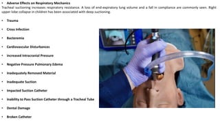 Medical suction apparatus.Pdf. Ygfhgcghhf | PPT